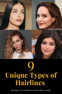 9 Types of Hairlines You Never Knew Existed! - Cosmetics Arena