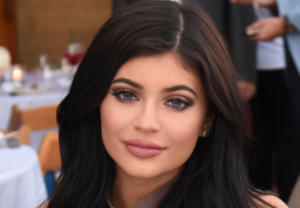 9 Types of Hairlines You Never Knew Existed! - Cosmetics Arena