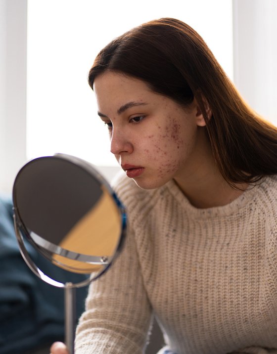 Check This Out If You Have A Scar Older Than 1 Year